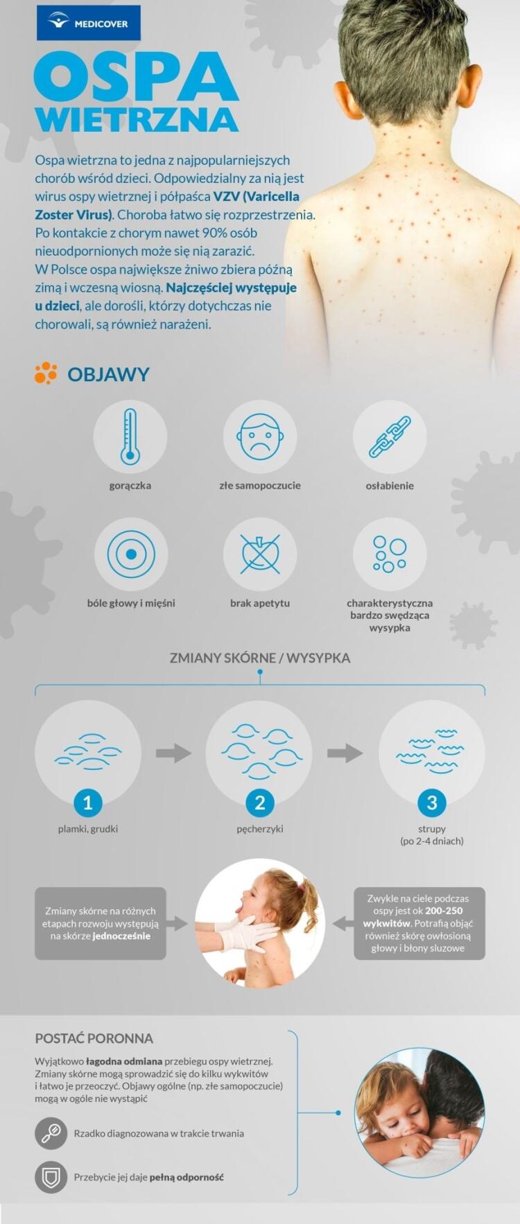 Ospa wietrzna - Gminne Przedszkole im. Dębowej Krainy w Dębem Wielkim